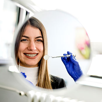 Invisalign, Braces Santa Barbara CA